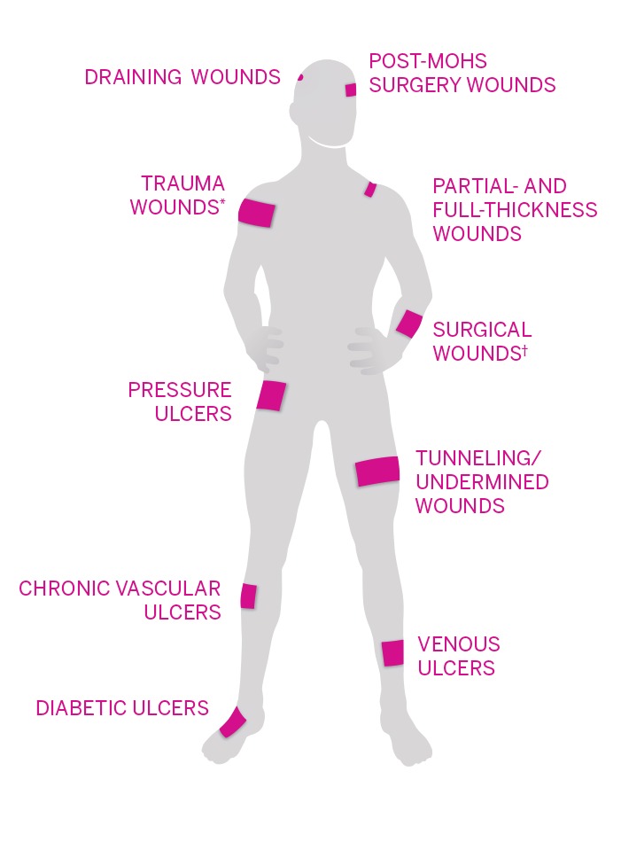 Types Of Open Wounds